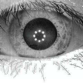 Image After The Localized Histogram Equalization Download Scientific Diagram