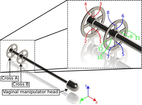 Double Cross Structure Attached To The Proximal Side Of The Vaginal Download Scientific Diagram