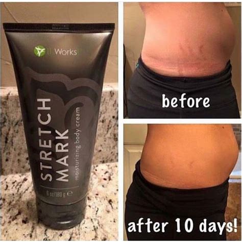 Pin By Simple Chef On Diet And Exercise Stretch Mark Cream Stretch