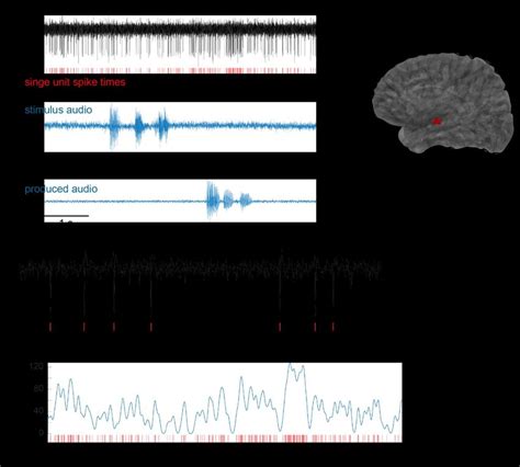 Extracellular Recordings Of Stn Neurons Were Performed Using Download Scientific Diagram
