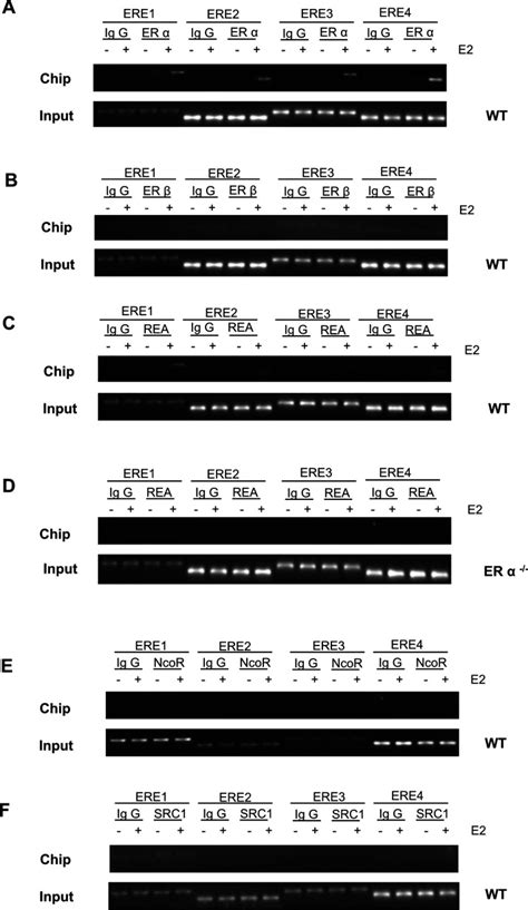 Sex Specific Regulation Of β Secretase A Novel Estrogen Response Element Ere Dependent