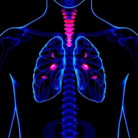 Innovative Diagnostic Method Promises Major Advances In Tuberculosis