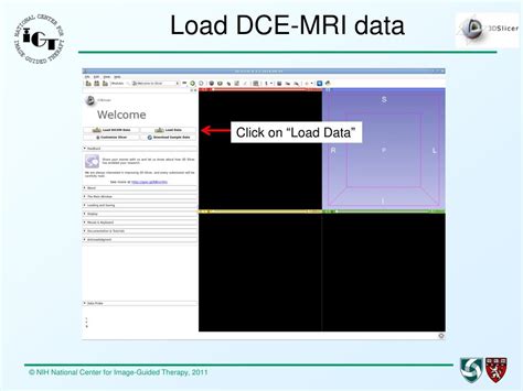Ppt Tumor Segmentation From Dce Mri With The Segmentcad Module