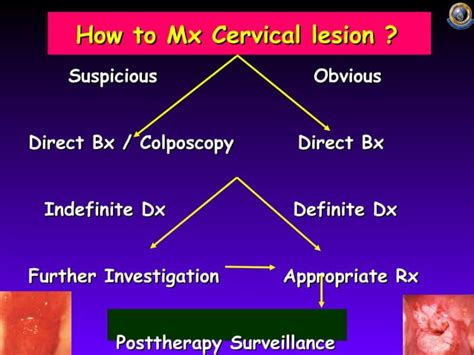 Abnormal pap smear ศรราช ppt PPT