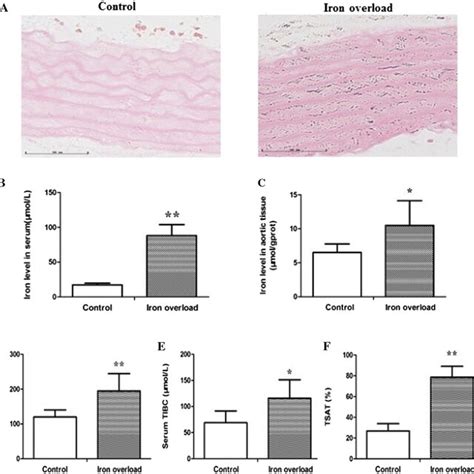 Expression Of Factors Related To Calcification In Aortic Tissue Of Iron Download Scientific