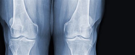 Adductor Canal Block Maverick Medical Education