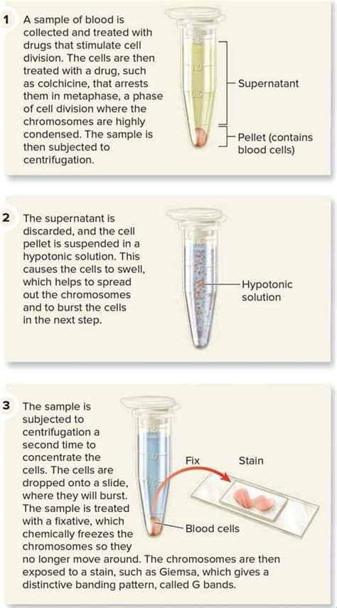 Hanaa Fayed On Linkedin The Procedure For Making A Karyotype ‼️ In This Example The Chromosomes…