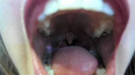 Amie E Asmr Close Uvula Manyvids