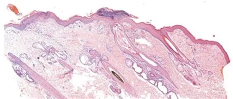 Canine Pyoderma A Common Dermatological Challenge Nationwide