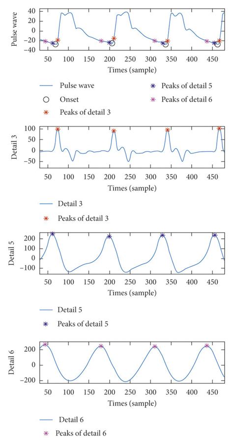 Onset Detection Based On Swt Detail 3 Detail 5 And Detail 6 Mean Download Scientific Diagram