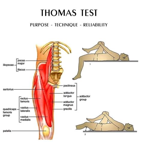Psoas Test