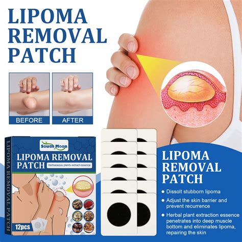 South Moon Lipoma Removal Patch 12pcs Lumpfree Lipoma Removing Patch