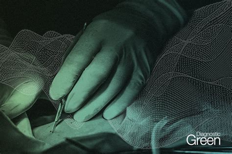 Augmented Reality And Icg For Precise Liver Resection