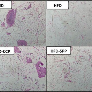Effect Of CCP And SPP On Architecture And Diameter Of Adipocyte Download Scientific Diagram