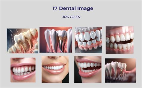 The Beautiful Appearance Of The Teeth Templatemonster
