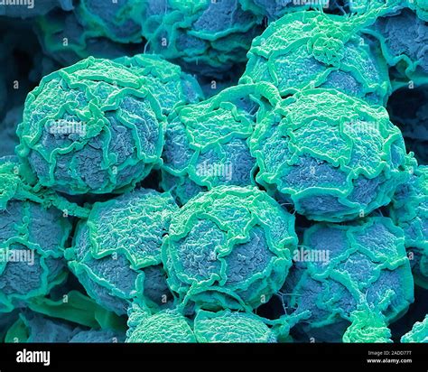 Botryococcus Alga Coloured Scanning Electron Micrograph Sem Of