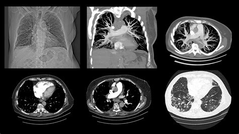 Somatom Goup Made To Match Siemens Healthineers Usa