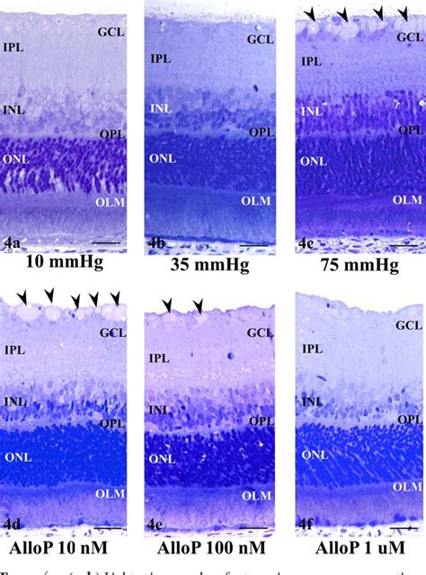 Axonal Swelling Semantic Scholar