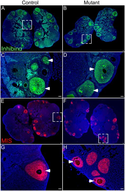 Normal Follicular Development In Ovaries Of Control And Mutant Mice