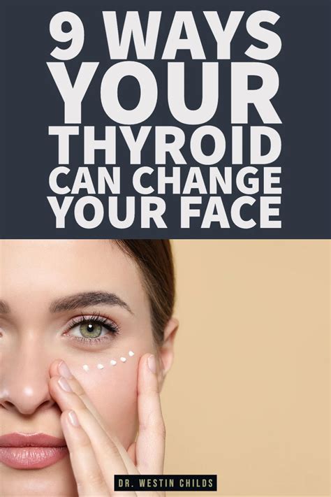 Hypothyroidism Before And After Face
