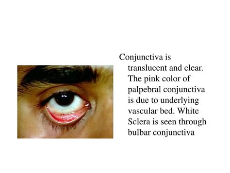 Bulbar Conjunctiva