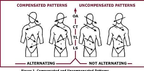 Figure 11 From The Common Compensatory Pattern Its Origin And Relationship To The Postural