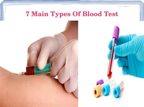 PPT 7 Main Types Of Blood Test PowerPoint Presentation Free Download ID 7526662