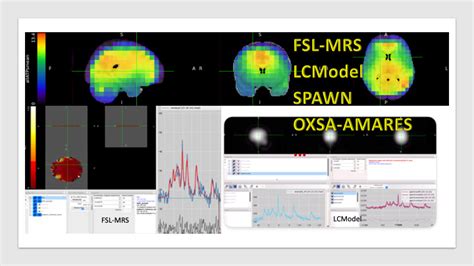 basis set simulation for 31p mrs data analysis data processing mrshub forum