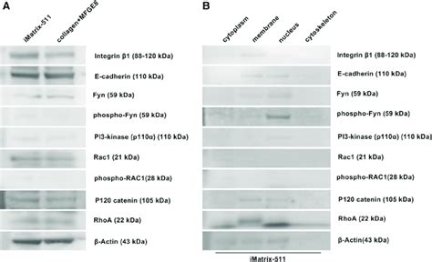 Western Blotting A Western Blot Assay Image Of E Cadherin Integrin