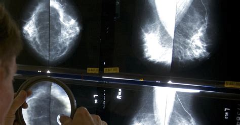 mammograms will better explain what it means to have dense breasts