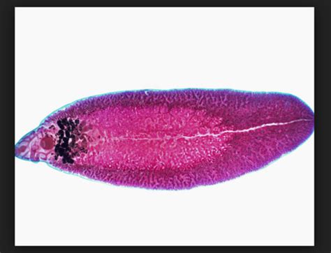 Liver Fluke Under Microscope Could Better Liver Fluke Control Reduce