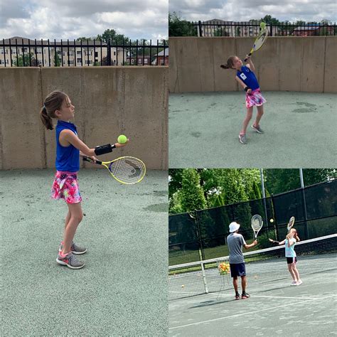 Activity Specific Prosthetics Congenital Hand And Arm Differences