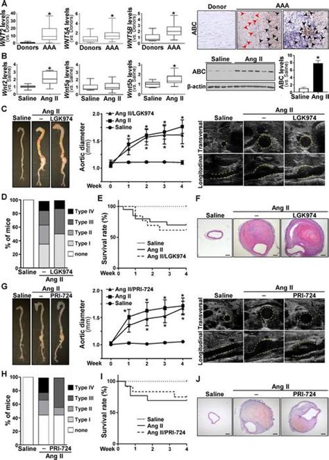 Activation Of Wnt Signaling In IMAGE EurekAlert Science News Releases