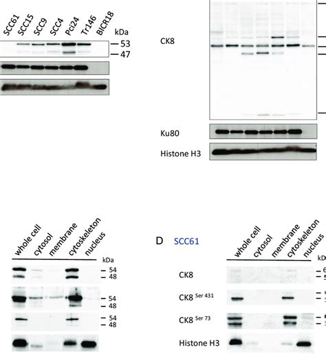 Proteomic Analysis Identifies The 54 Kda Isoform As The Main Membrane