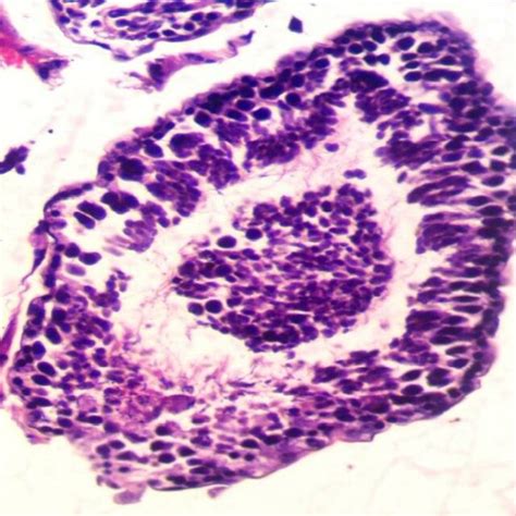 Rat Testis After Tribestan Administration In Combination With Serotonin