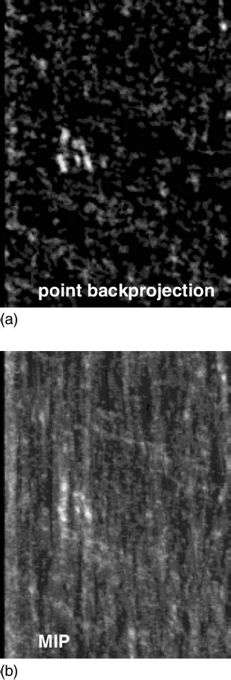 Figure 1 From Automated Detection Of Microcalcification Clusters For Digital Breast