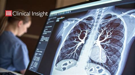 Effective Lung Segments On Ct A Practical Guide Pycad Your Medical Imaging Partner