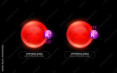 Potassium In Red Blood Cells With Up Down Arrows On Black Background
