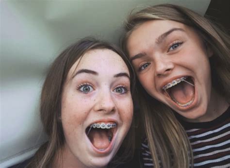 Cute Braces Pic Cute Braces Braces Girls Cute Girls With Braces