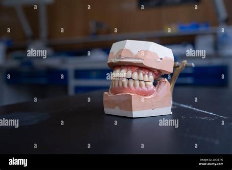 A Denture Model On A Laboratory Table With Some Working Utensils It Is
