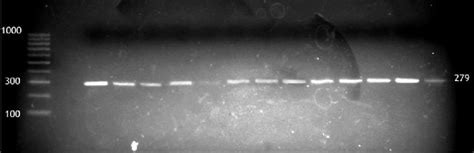 Electropherotic Profile Of Staphylococcus Aureus Isolates Positive Nuc Download Scientific