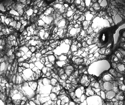 Human Precision Cut Lung Slice Pcls 001f 28 Male Hispanic Cell