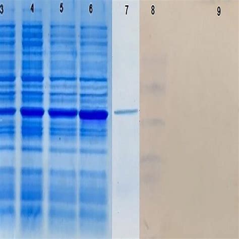 Analysis Of Expression And Purification Of The Recombinant Chimer
