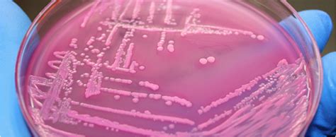 Contract Testing Consultation Center For Applications In Biotechnology Cal Poly San Luis