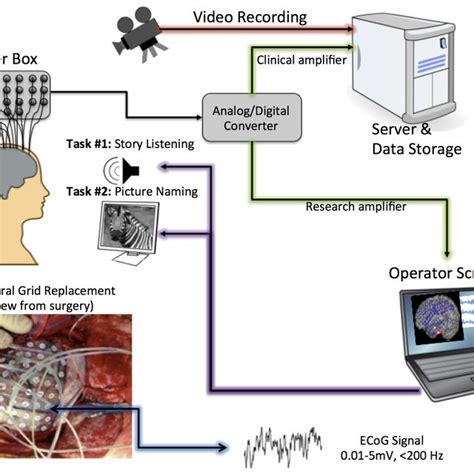 Language Specific Areas In The Brain Download Scientific Diagram