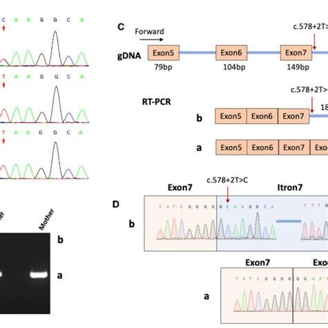 Figure Genetic Diagnosis And Rna Analysis A Sanger Sequencing