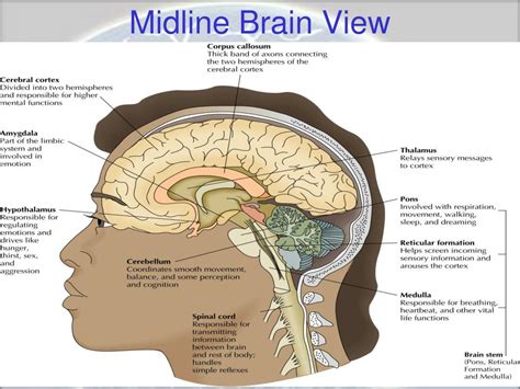 What Is A Midline Shift Of The Brain At Rene Ackerman Blog