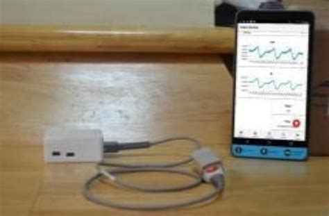 Non Invasive Estimation Of Cholesterol Through Photoplethysmography Leveraging Iomt And Ai