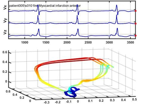 Pdf Matlab Code Spatiotemporal Representation Of Cardiac Signals