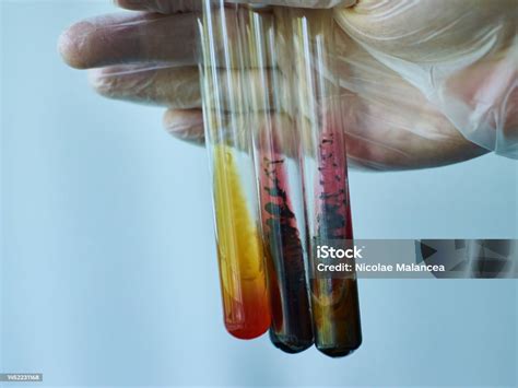 다양한 박테리아 배양 배지 시험관 미생물학 실험실 테스트 Stem 주제에 대한 스톡 사진 및 기타 이미지 Stem 주제 건강 진단 건강관리와 의술 Istock
